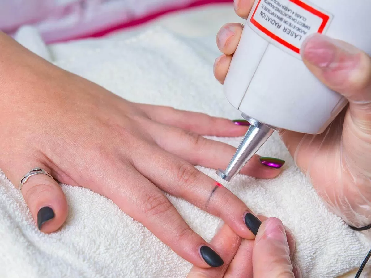 Types of tattoo removal methods - Tattoo Removal Pro Shop
